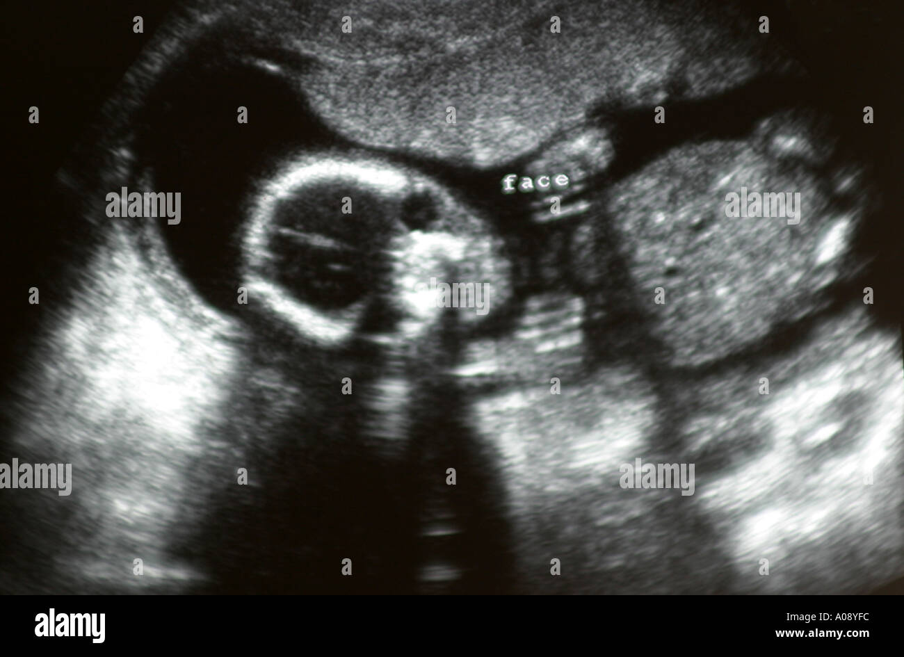Womb foetus hands hi-res stock photography and images - Alamy