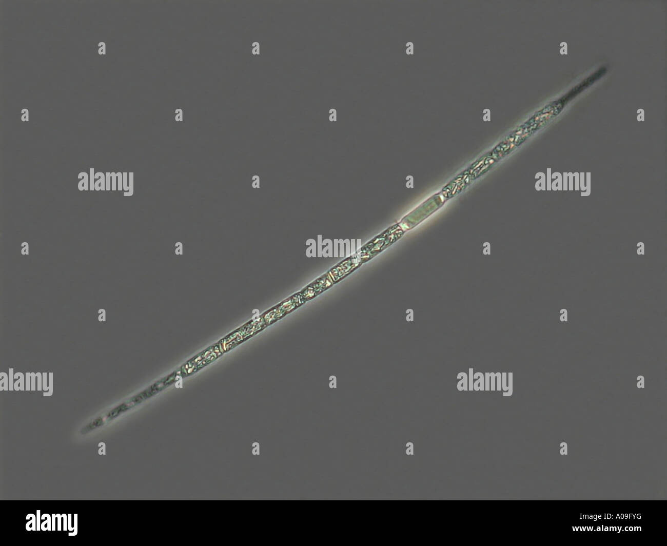 Aphanizomenon hi-res stock photography and images - Alamy