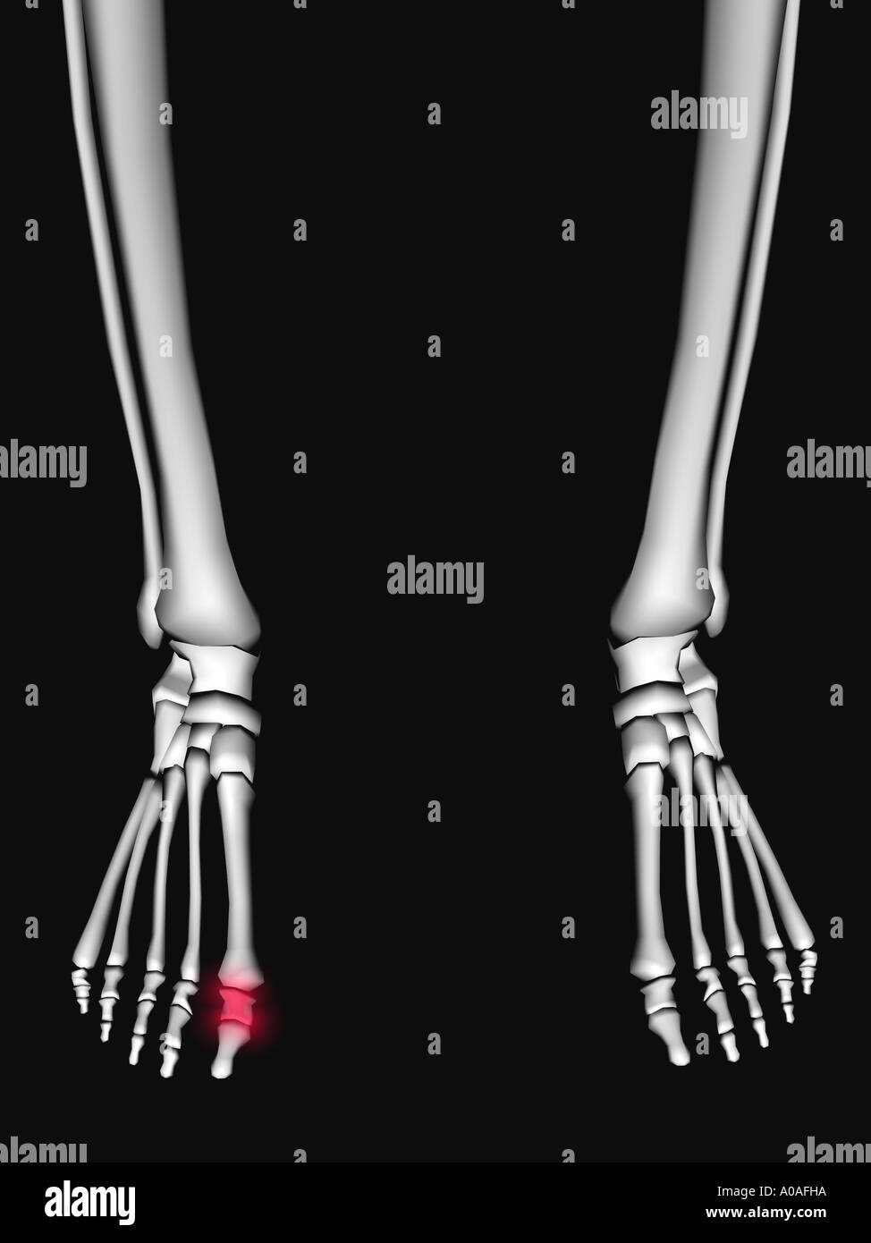Illustrative diagram showing skeleton showing one phalanges highlighted ...