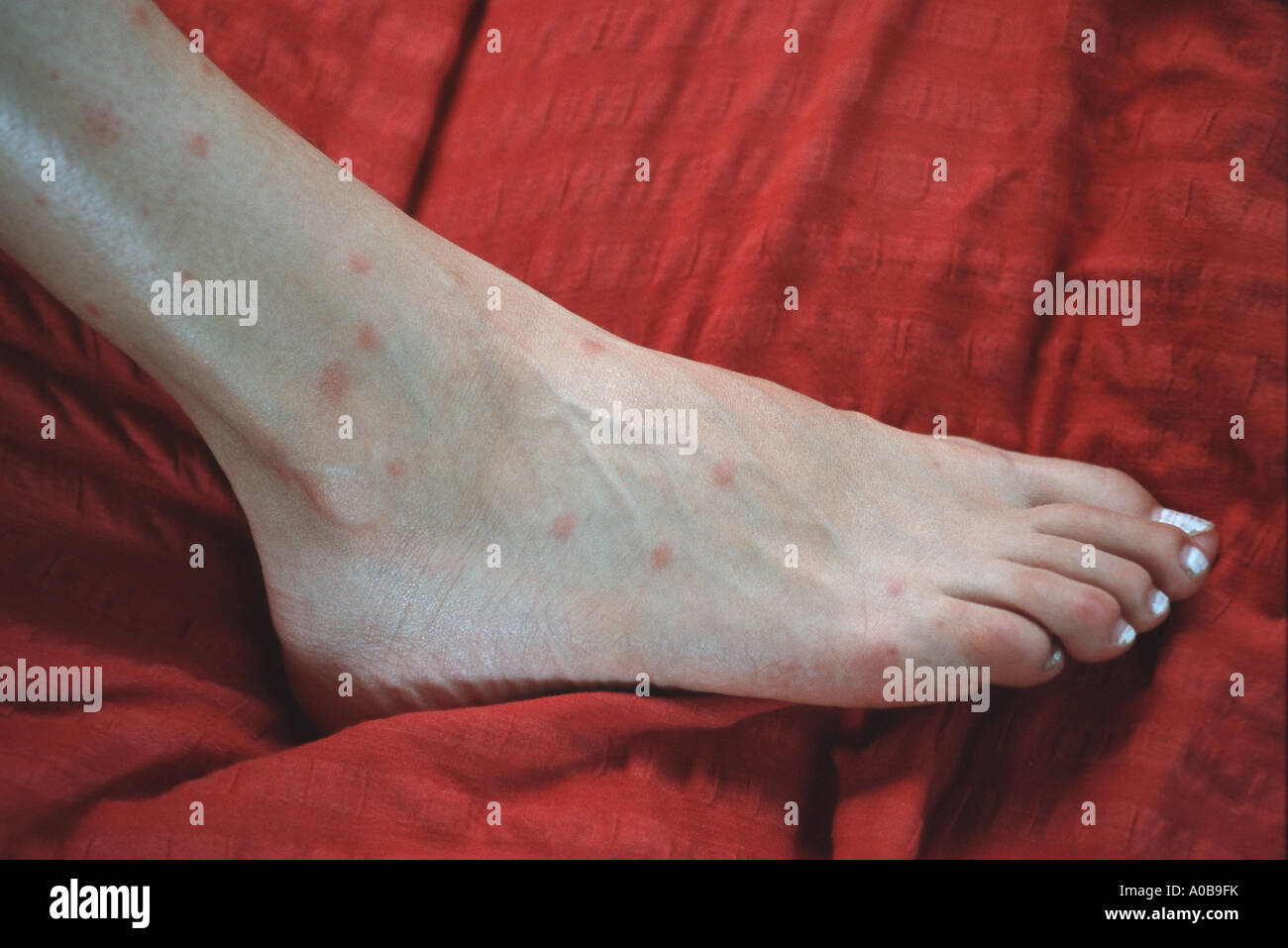 Mosquito feet hi-res stock photography and images - Alamy