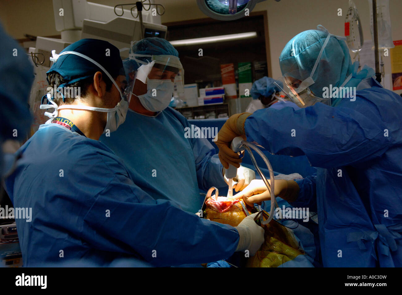 Total right knee replacement operation using a gender specific ...