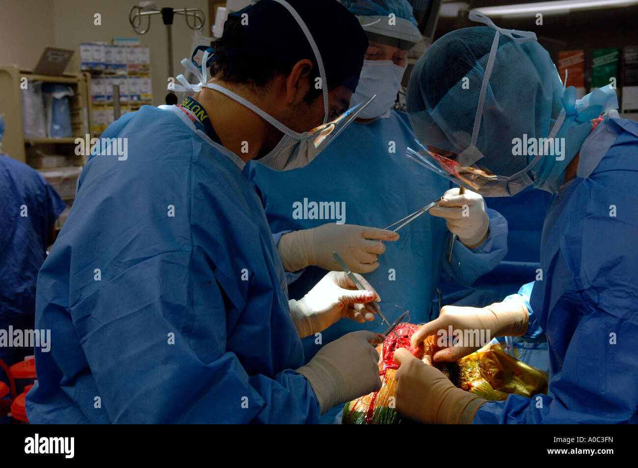 Total right knee replacement operation using a gender specific ...