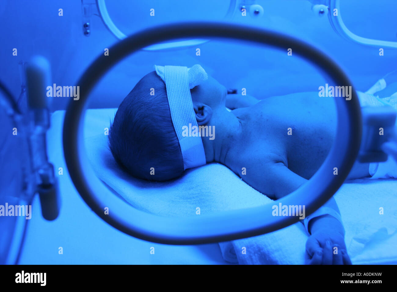 Phototherapy unit hi-res stock photography and images - Alamy