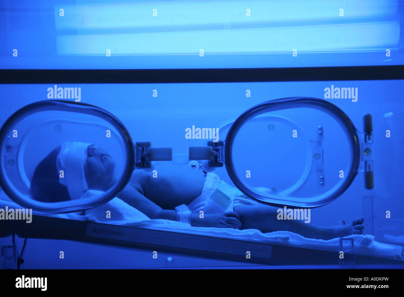 Premature baby with jaundice having phototherapy Stock Photo - Alamy