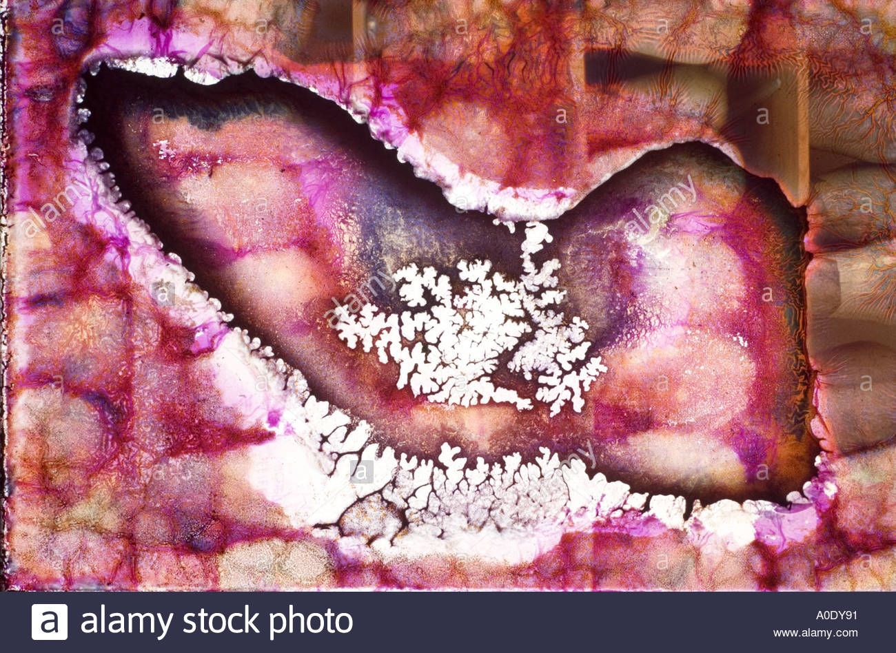 Acid Burns Stock Photos & Acid Burns Stock Images - Alamy