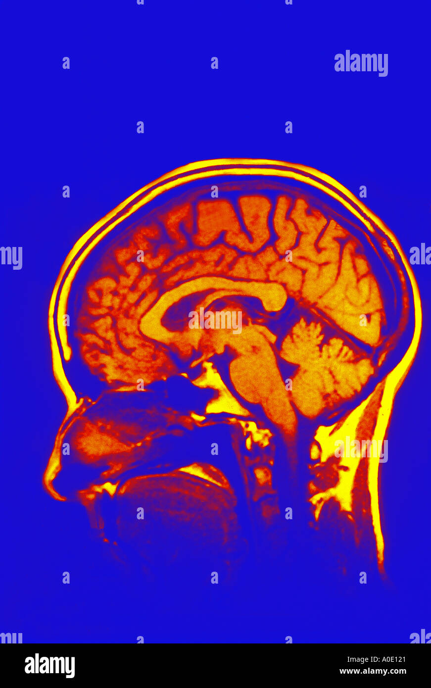 Mri brain scan hi-res stock photography and images - Alamy