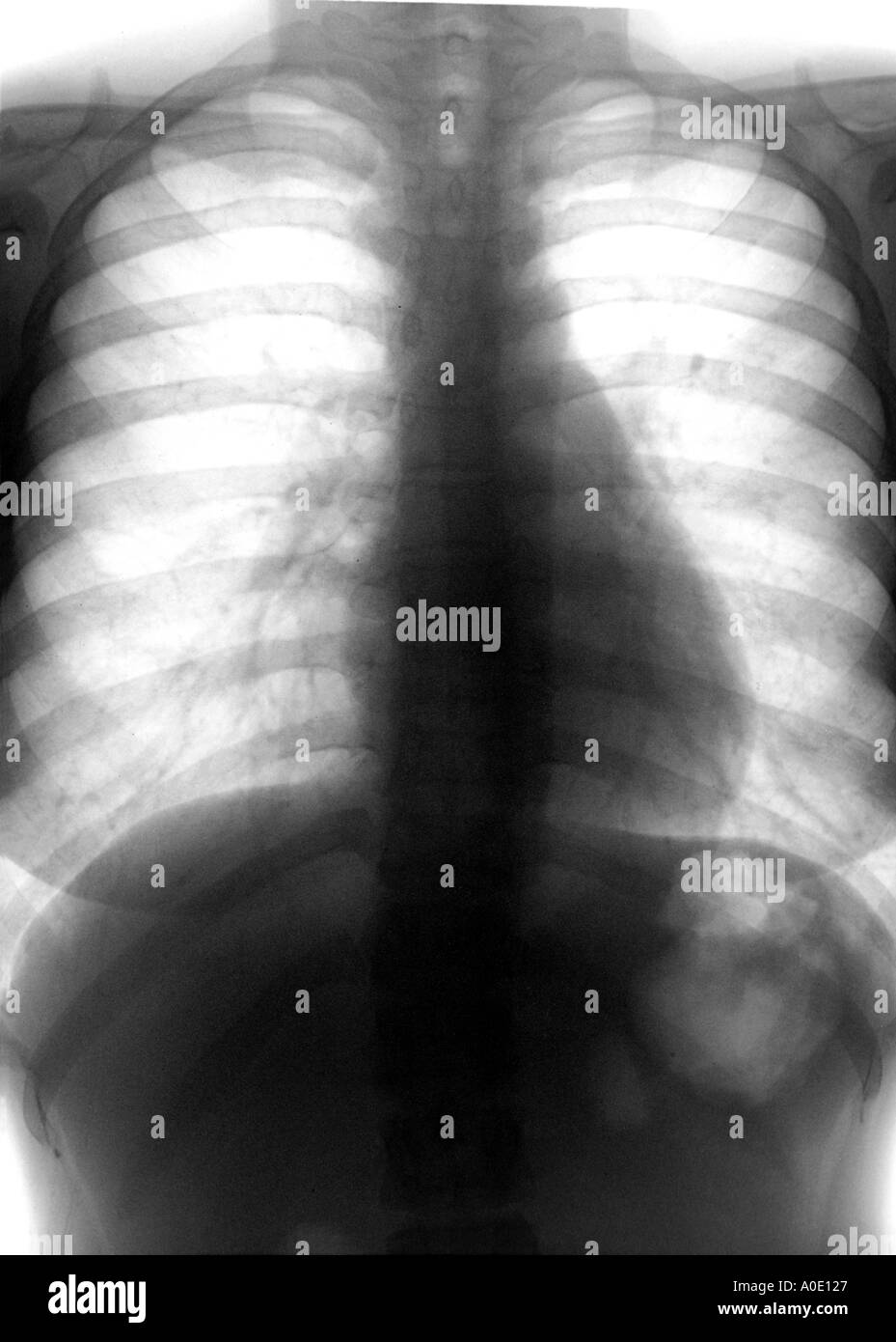 Inside chest Black and White Stock Photos & Images - Alamy