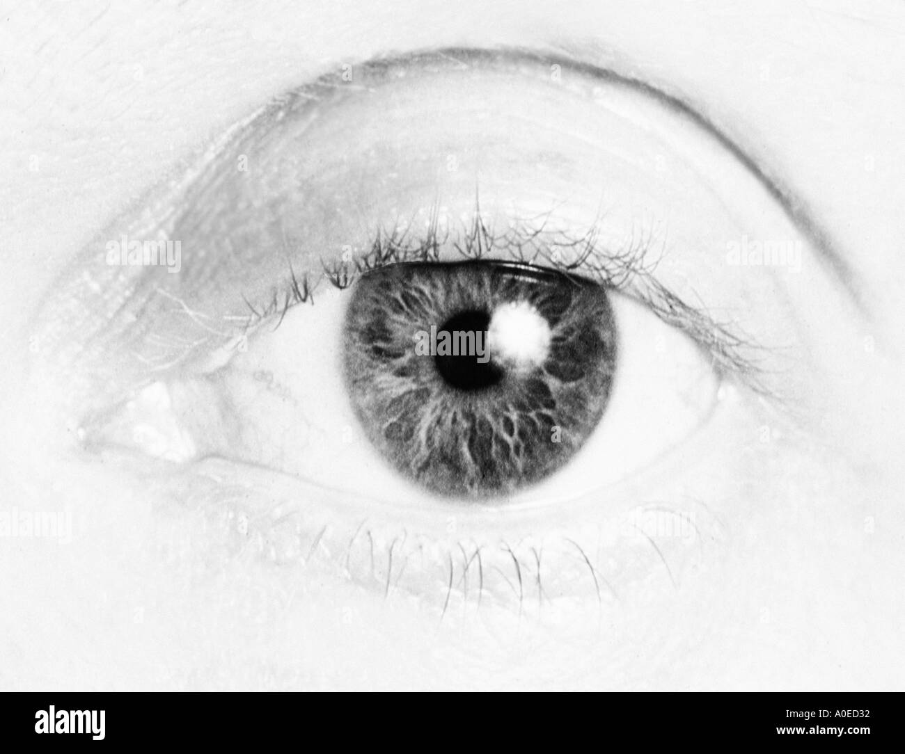 Eye lid Black and White Stock Photos & Images - Alamy