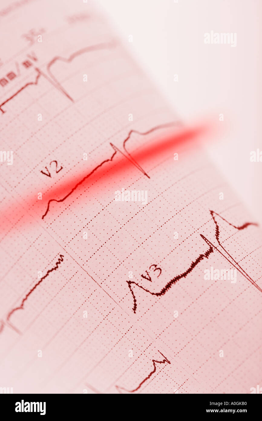 Reading medical charts hi-res stock photography and images - Alamy