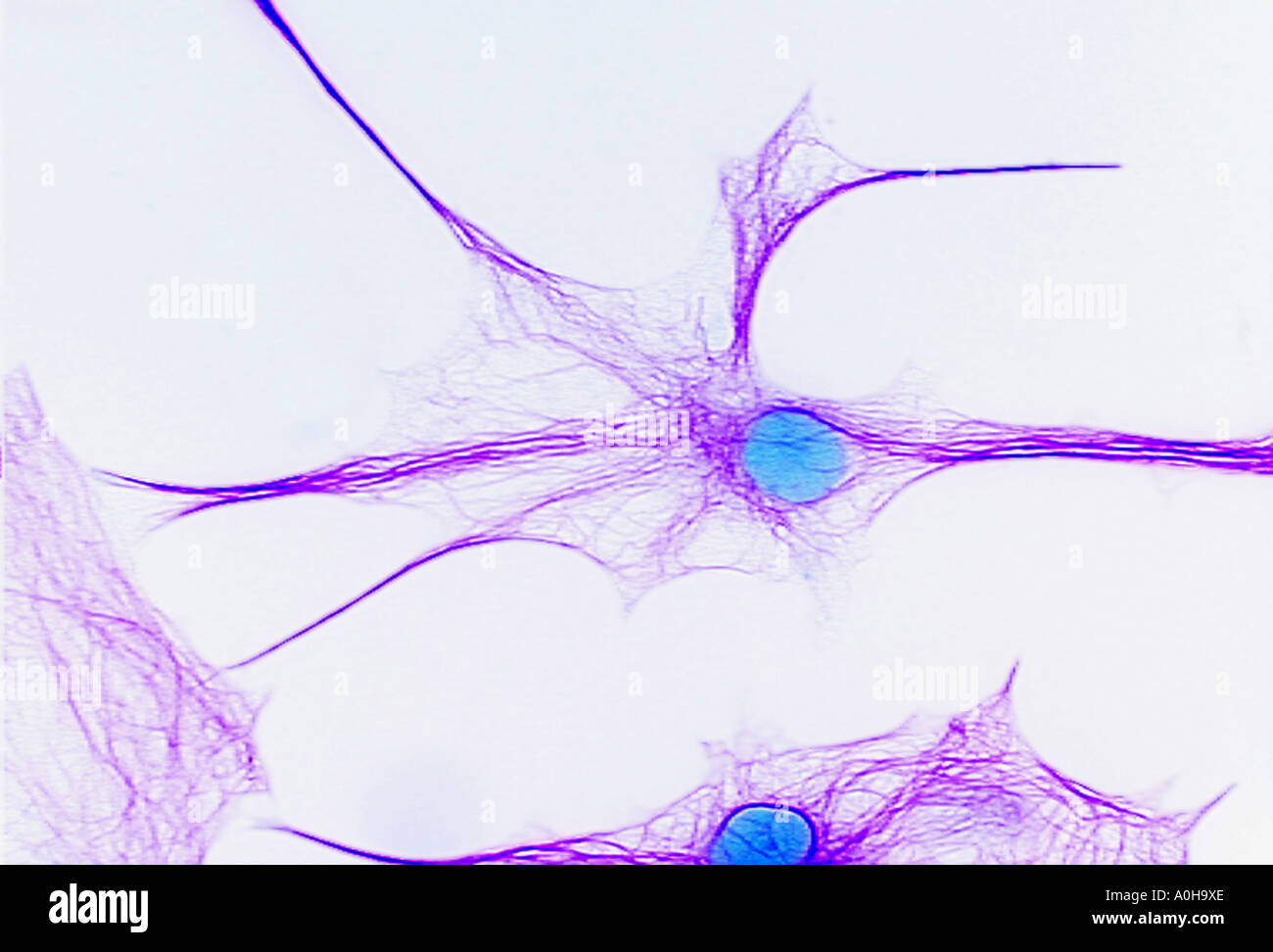 Brain cell micrograph hi-res stock photography and images - Alamy