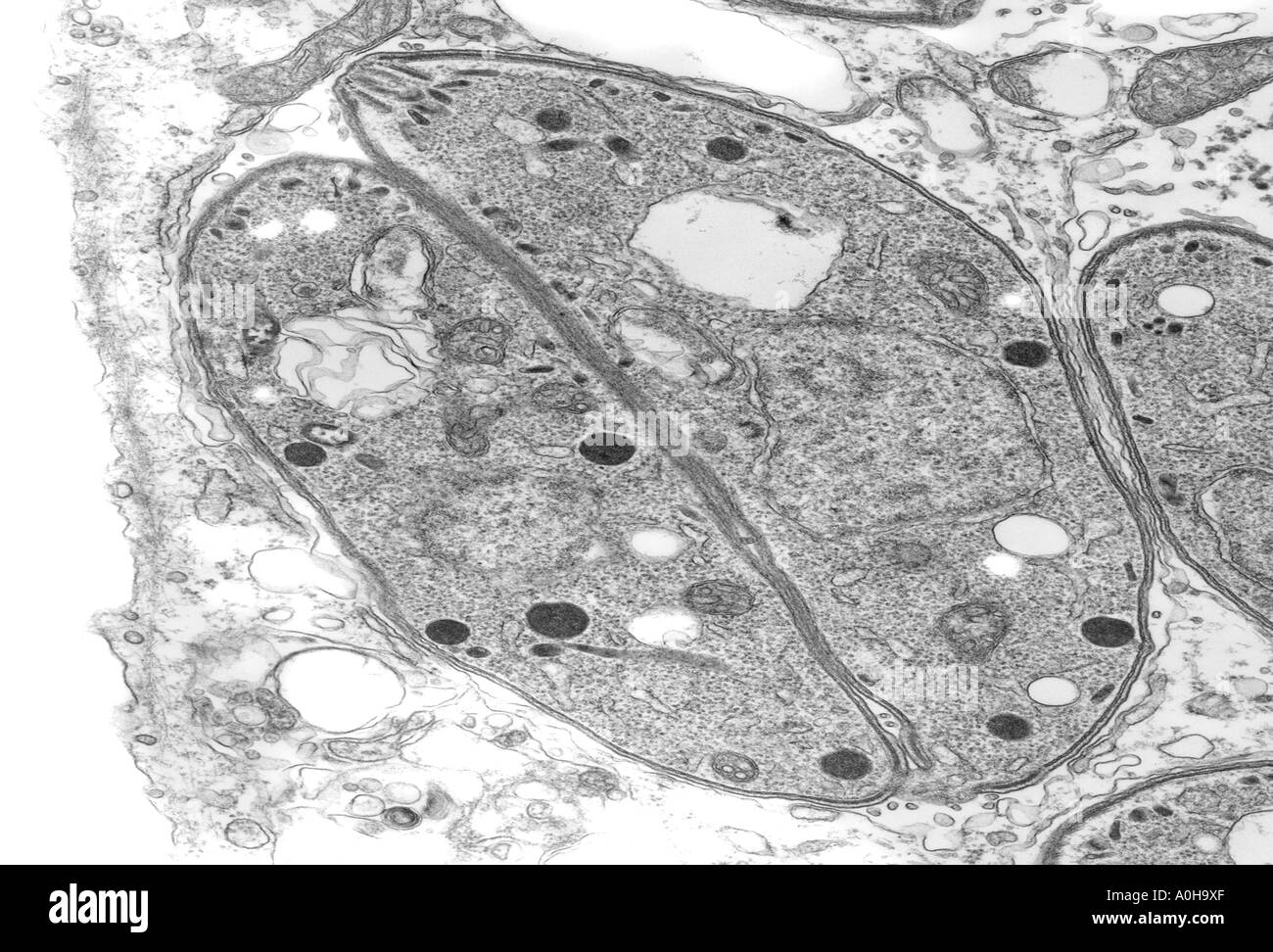 Neosporosis hi-res stock photography and images - Alamy