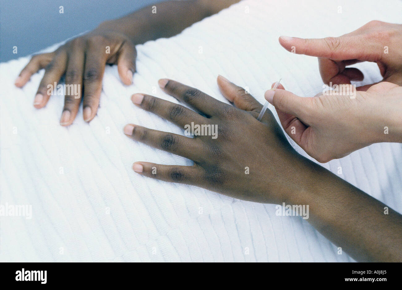 Eastern acupuncture hi-res stock photography and images - Alamy