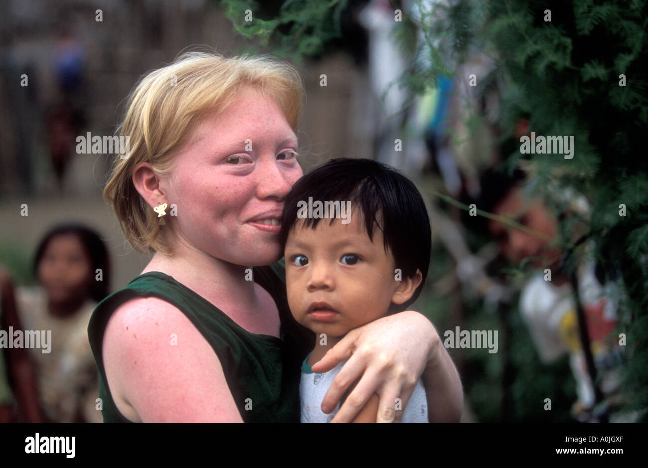 Albino girl on the San Blas Islands Panama Stock Photo - Alamy