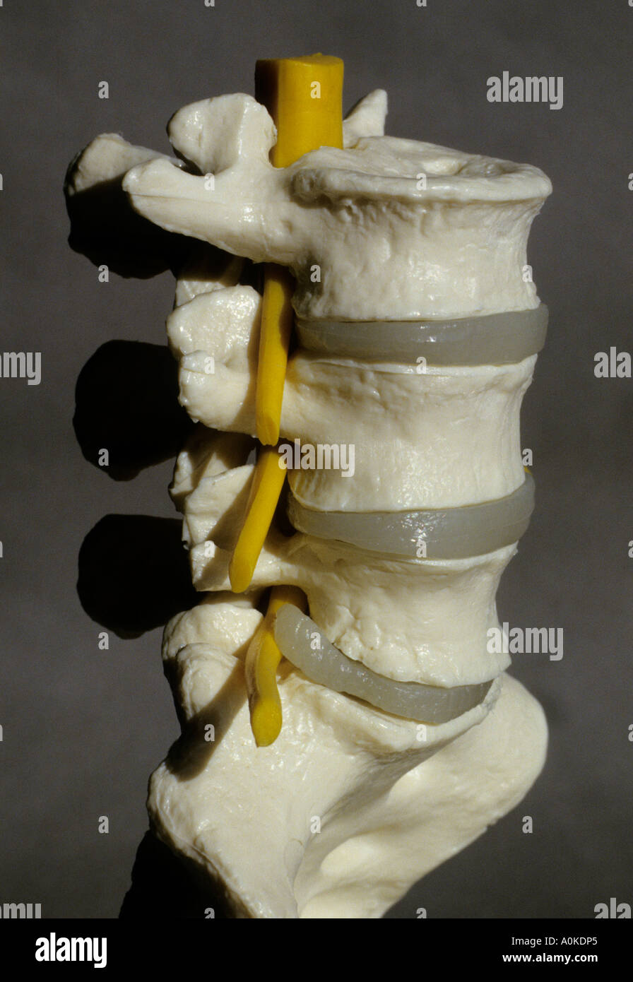 Model of base of human spine showing vertebrae with nerves and spinal ...