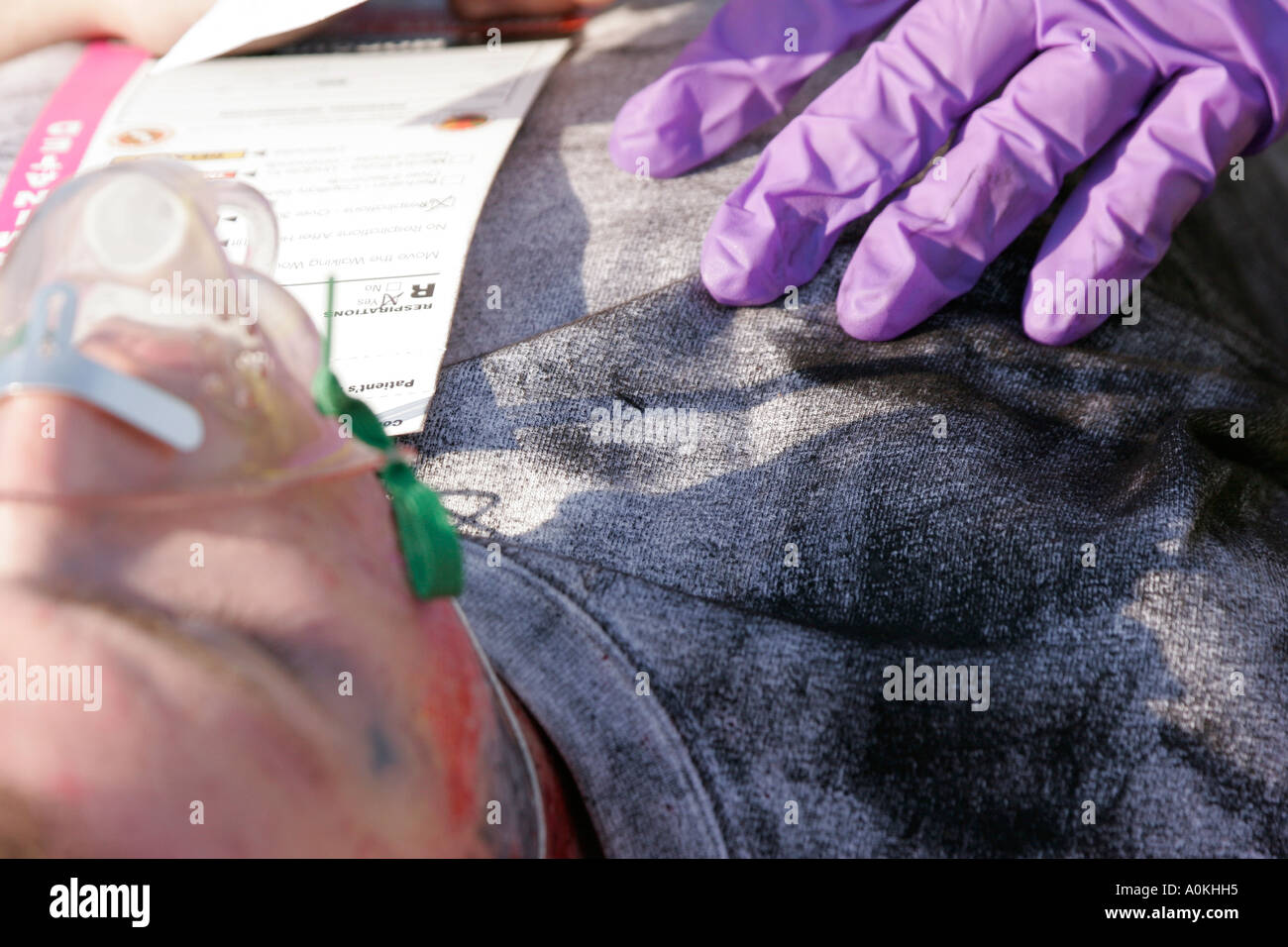 An Emt s hand is on a victim with oxygen Stock Photo - Alamy