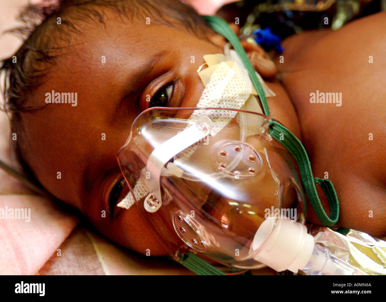sick aboriginal child Northern Territory, Australia, photo by Bruce ...