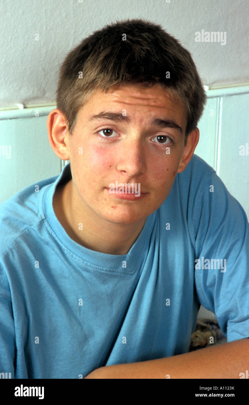 portrait spotty teenage boy Stock Photo - Alamy