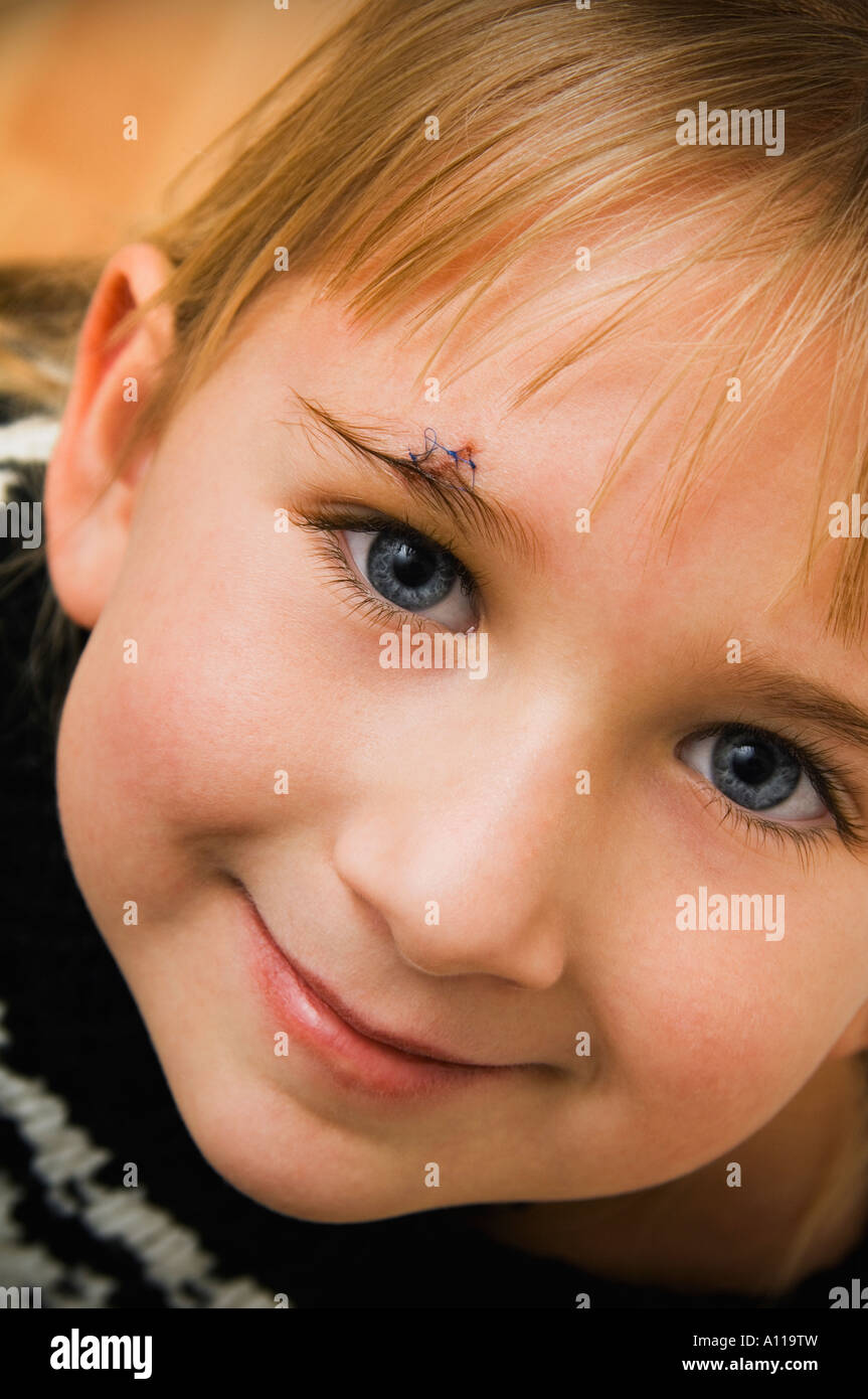 Stitches cut hi-res stock photography and images - Alamy