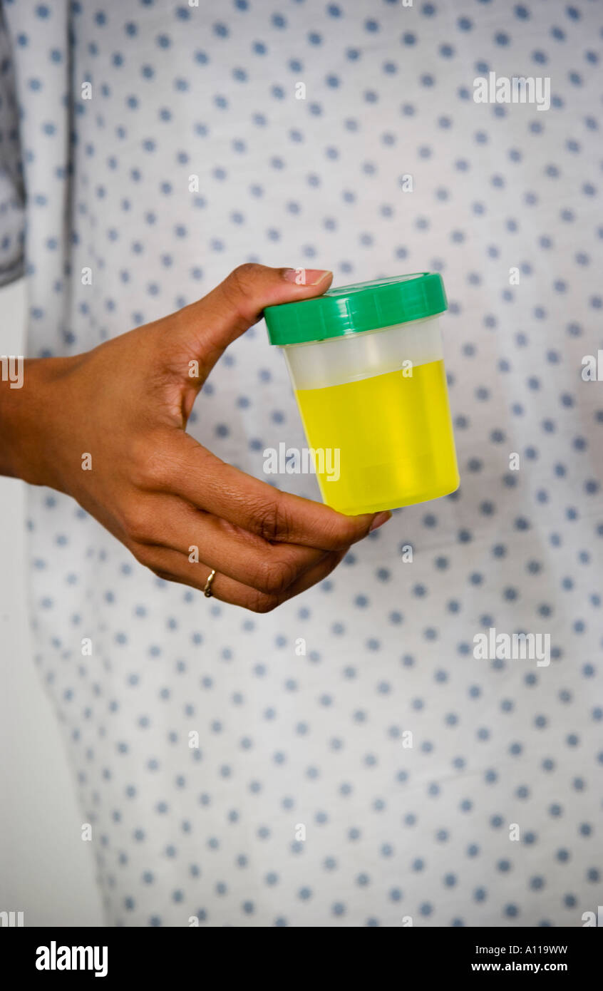 Patient holding urine sample Stock Photo - Alamy