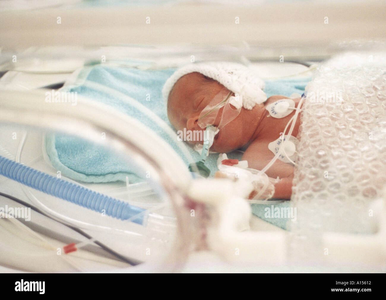 Baby ventilator hi-res stock photography and images - Alamy
