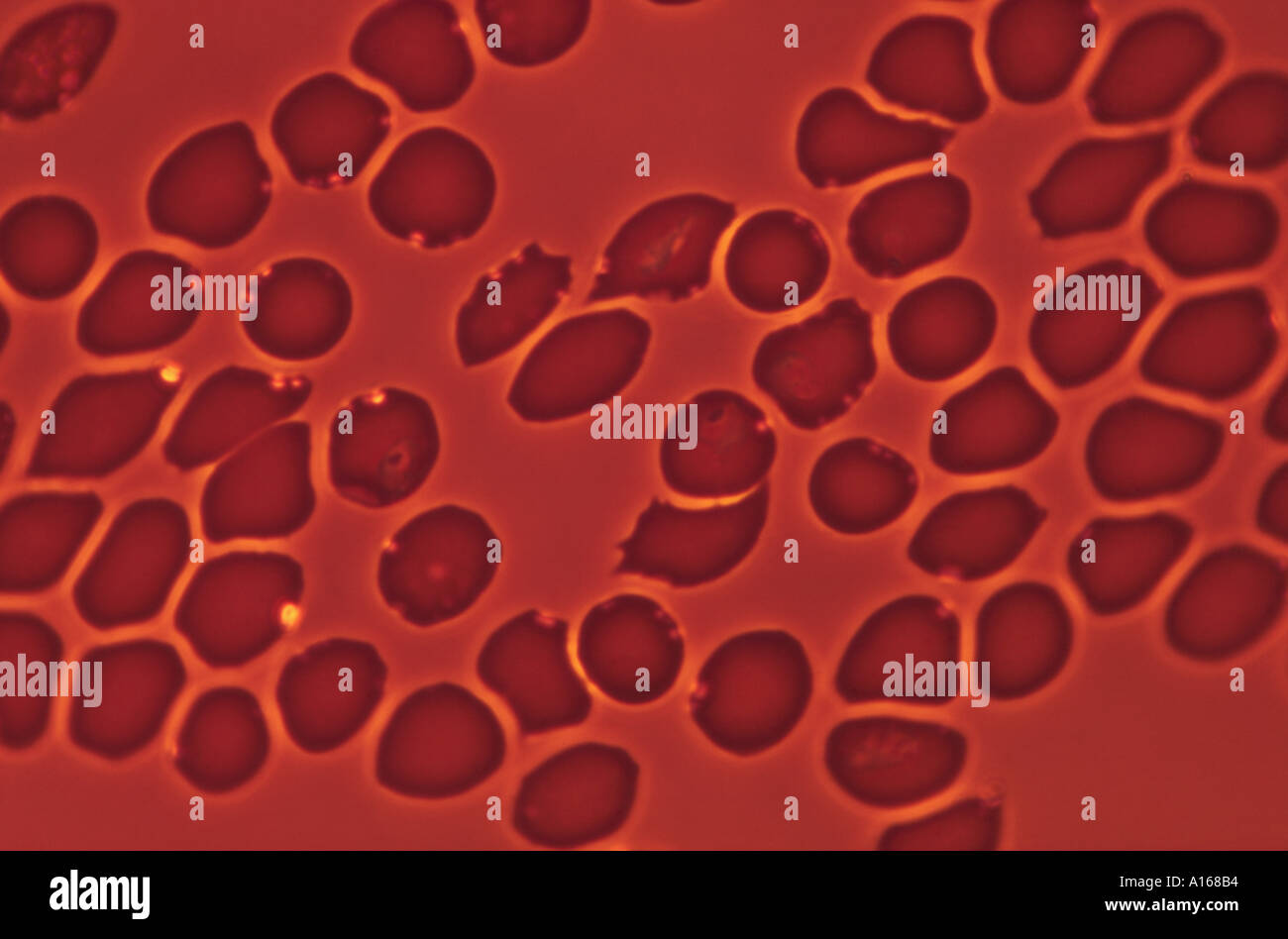 Sickle cell hi-res stock photography and images - Alamy