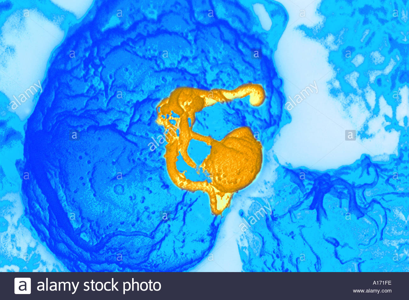 Hiv Micrograph High Resolution Stock Photography and Images - Alamy