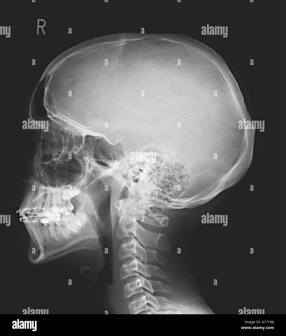 X ray studies hi-res stock photography and images - Alamy