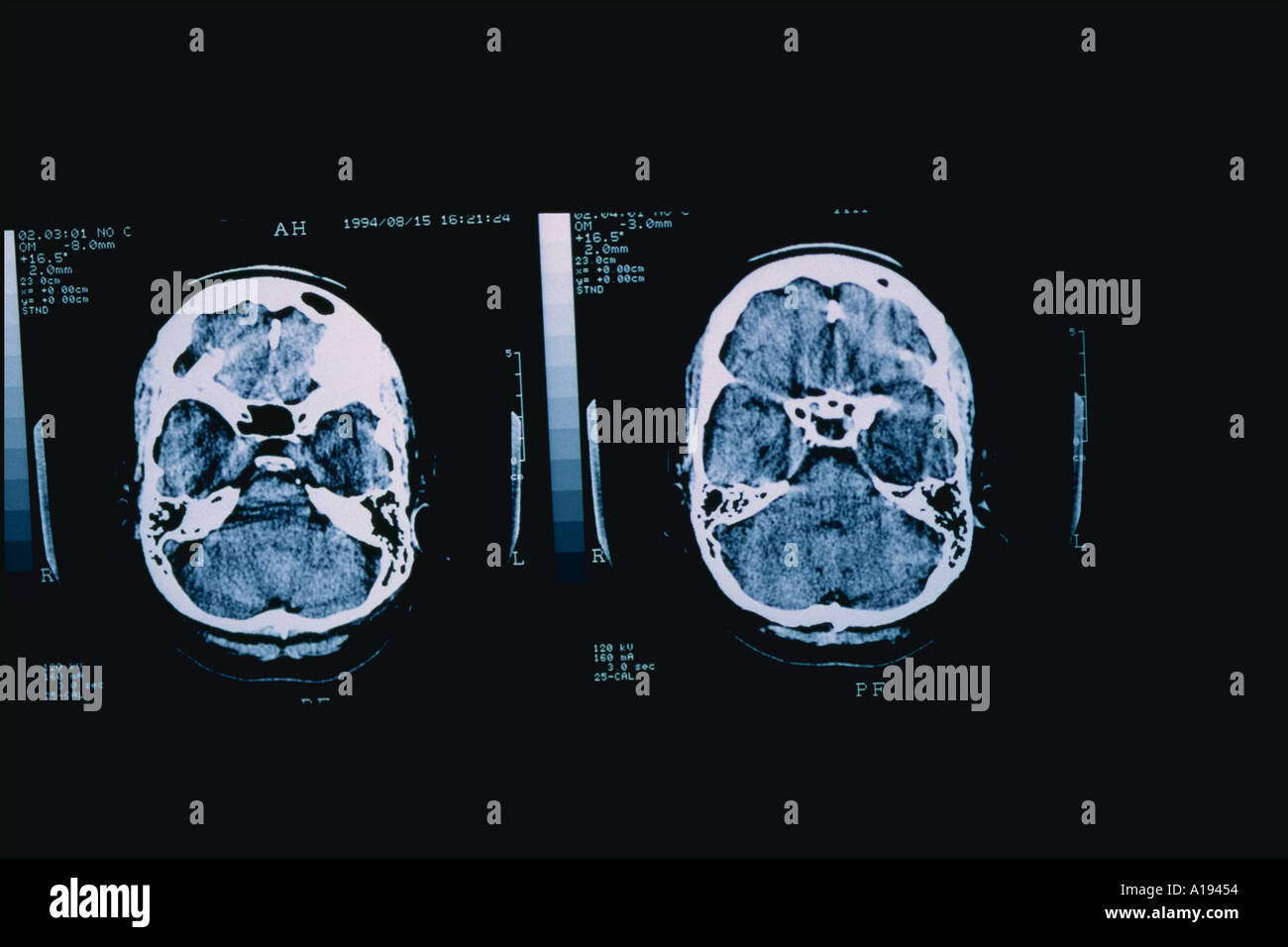 CT scans of a human brain Stock Photo - Alamy
