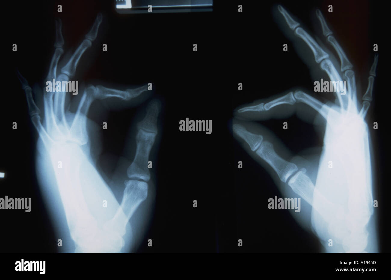 X ray human hand thumb pointer hi-res stock photography and images - Alamy