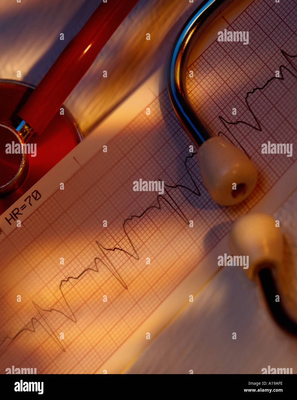 ECG trace and stethoscope Stock Photo - Alamy