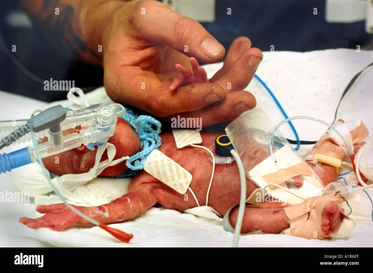 A premature baby in a special baby care unit Stock Photo - Alamy