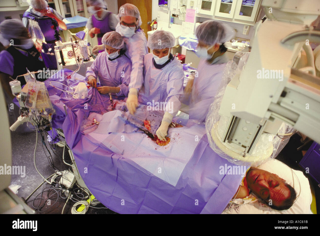 Dr Fayaz A Shawl interventional cardiologist performs a percutaneous ...