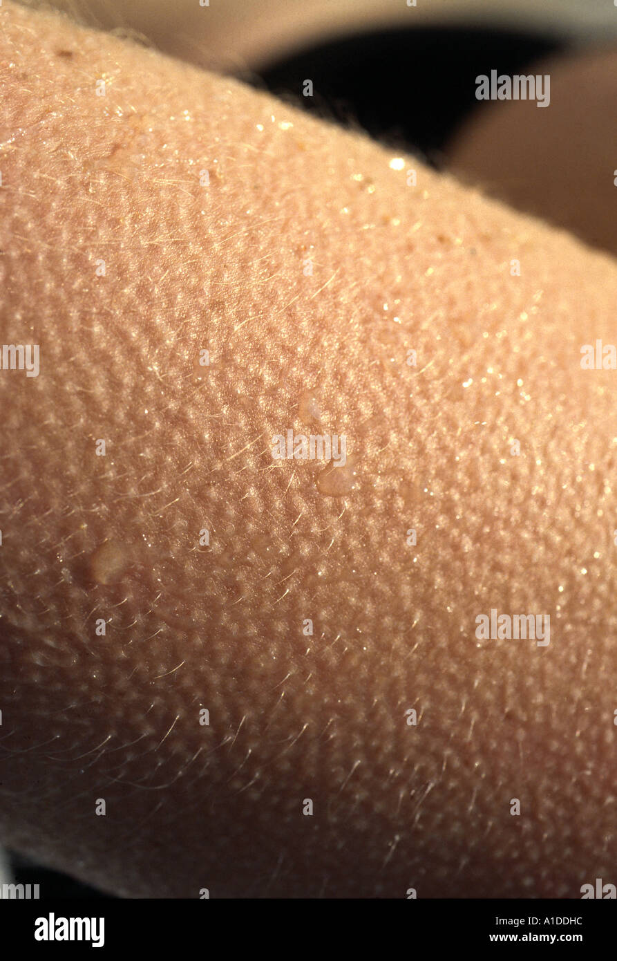 Close-up of human skin with goose bums Stock Photo - Alamy