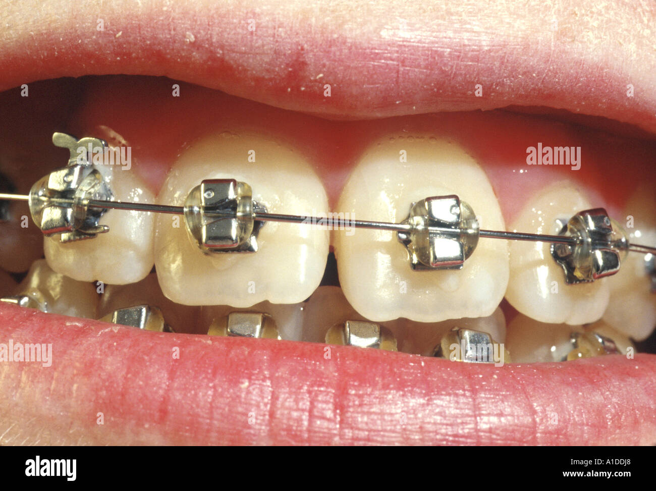 Ics image hi-res stock photography and images - Alamy