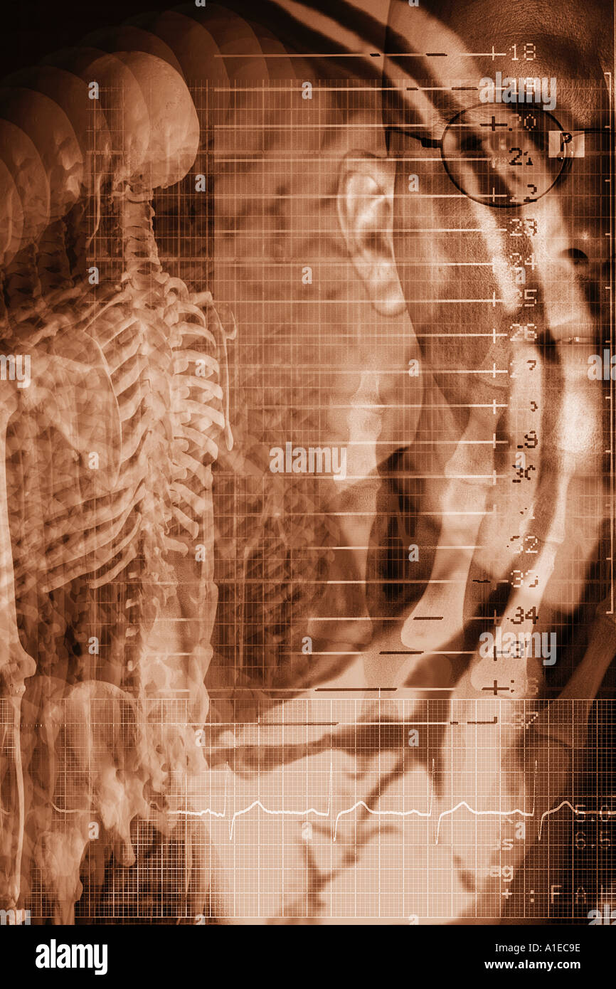 Precise imaging hi-res stock photography and images - Alamy