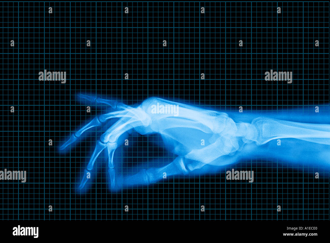 hand x ray Stock Photo - Alamy