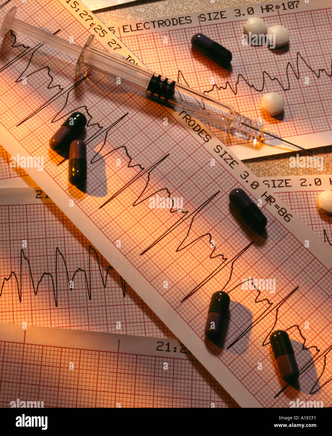 Cardiac drugs on ECG trace Stock Photo - Alamy
