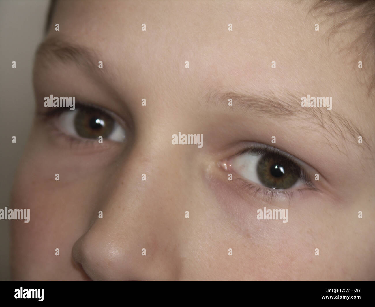 Boy s face nose and eyes Stock Photo - Alamy