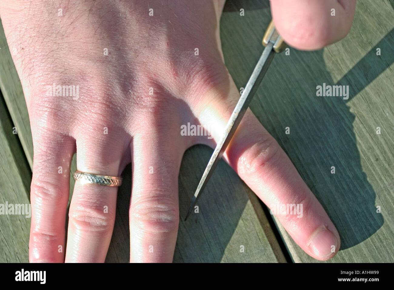 man cut s one finger Stock Photo - Alamy