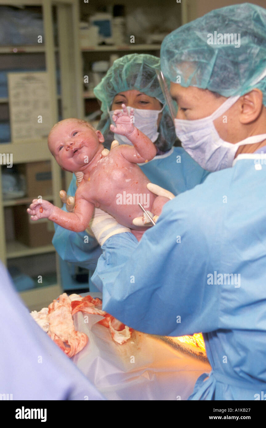 Mother gives birth to a baby boy Stock Photo - Alamy