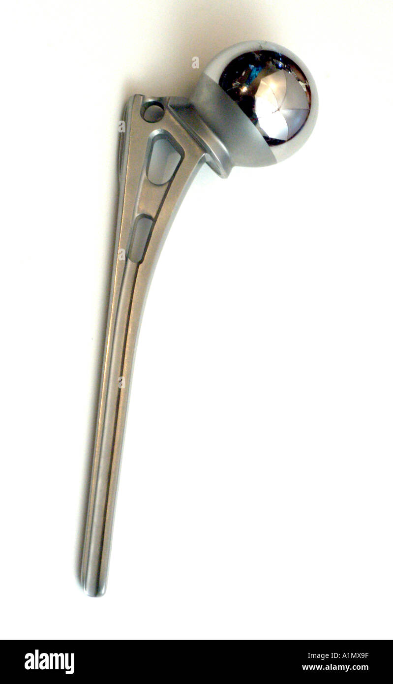 Artificial hip hi-res stock photography and images - Alamy