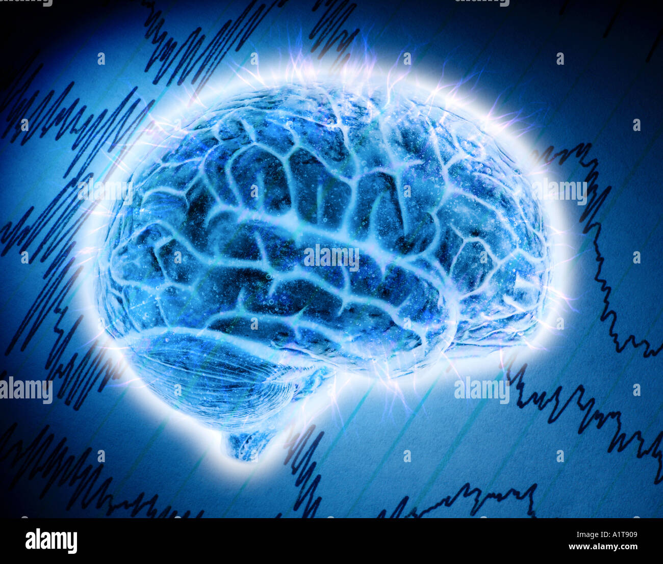 Eeg Stock Photos & Eeg Stock Images - Alamy