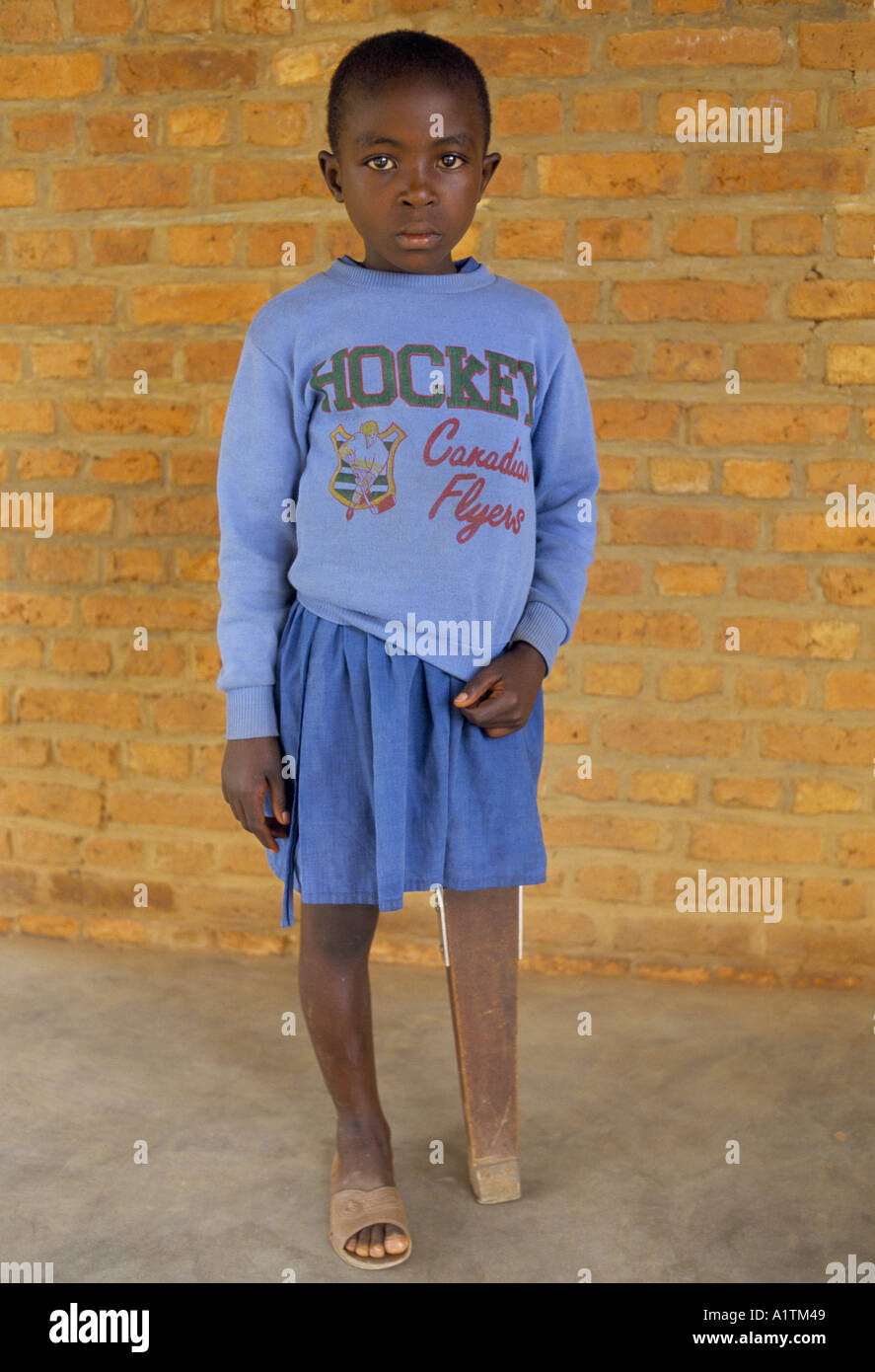 RETURN TO RWANDA MARCH 1995 RAMAKIRWE 6 WHO LOST HER LEG IN THE WAR ...