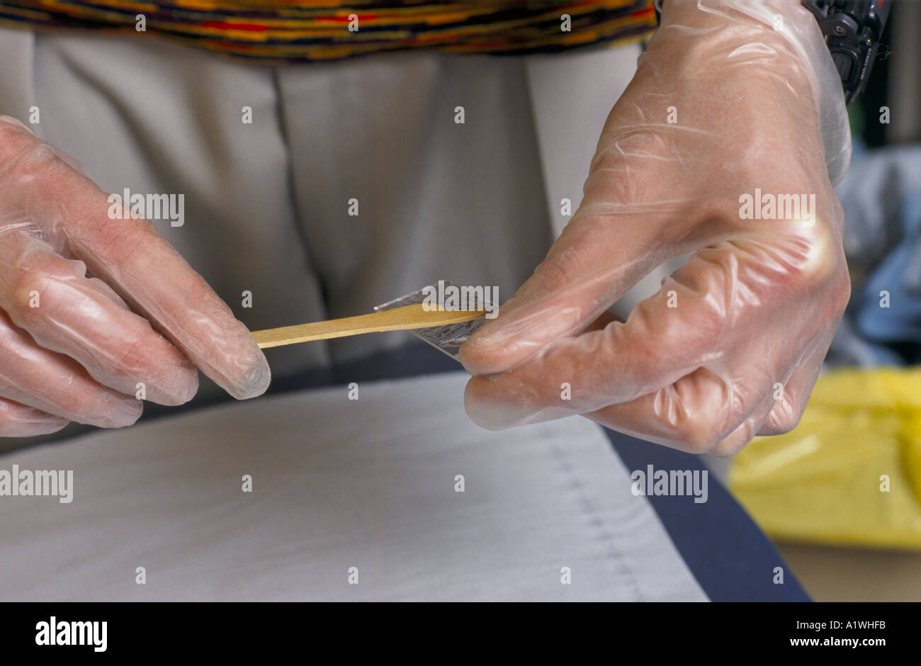 Cervical smear hi-res stock photography and images - Alamy