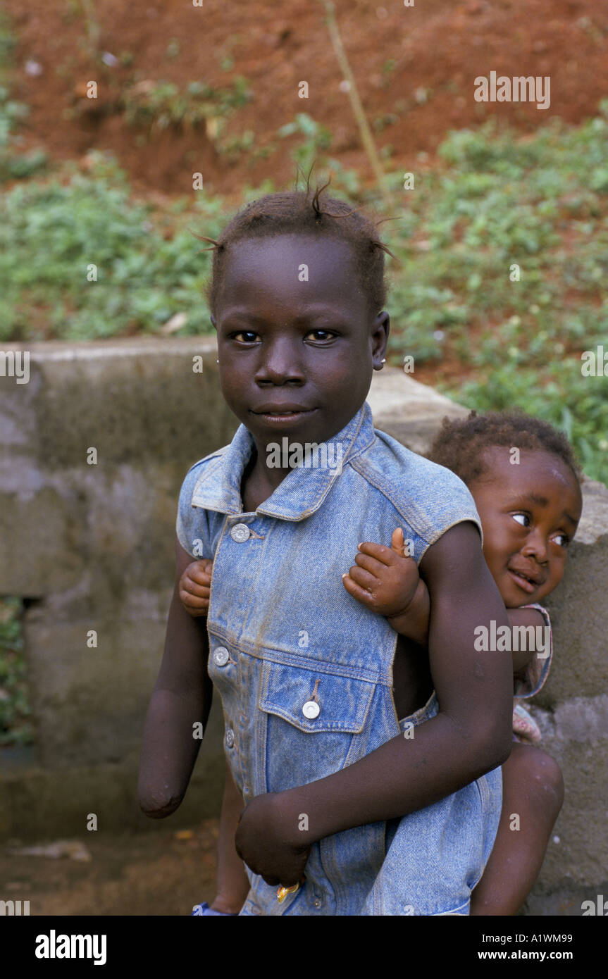 DAMBA, AMPUTEE CHILD WITH HAND CHOPPED OFF BY REBELS ,CARRYING BABY ON ...