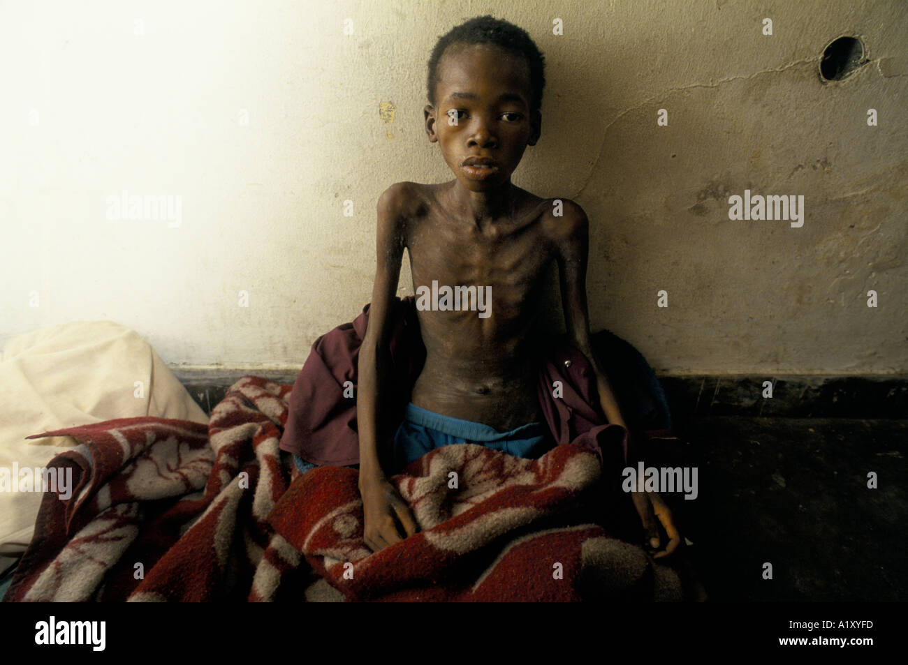 Child victim angola hi-res stock photography and images - Alamy