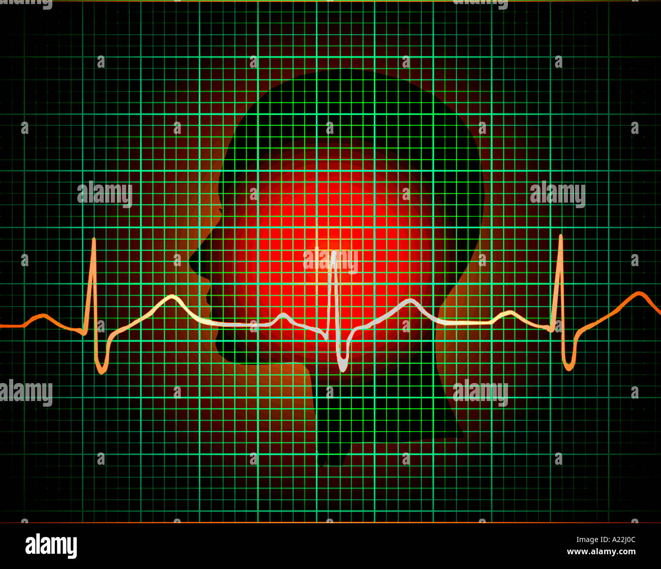 female robot profile on grid with EKG monitoring Stock Photo - Alamy