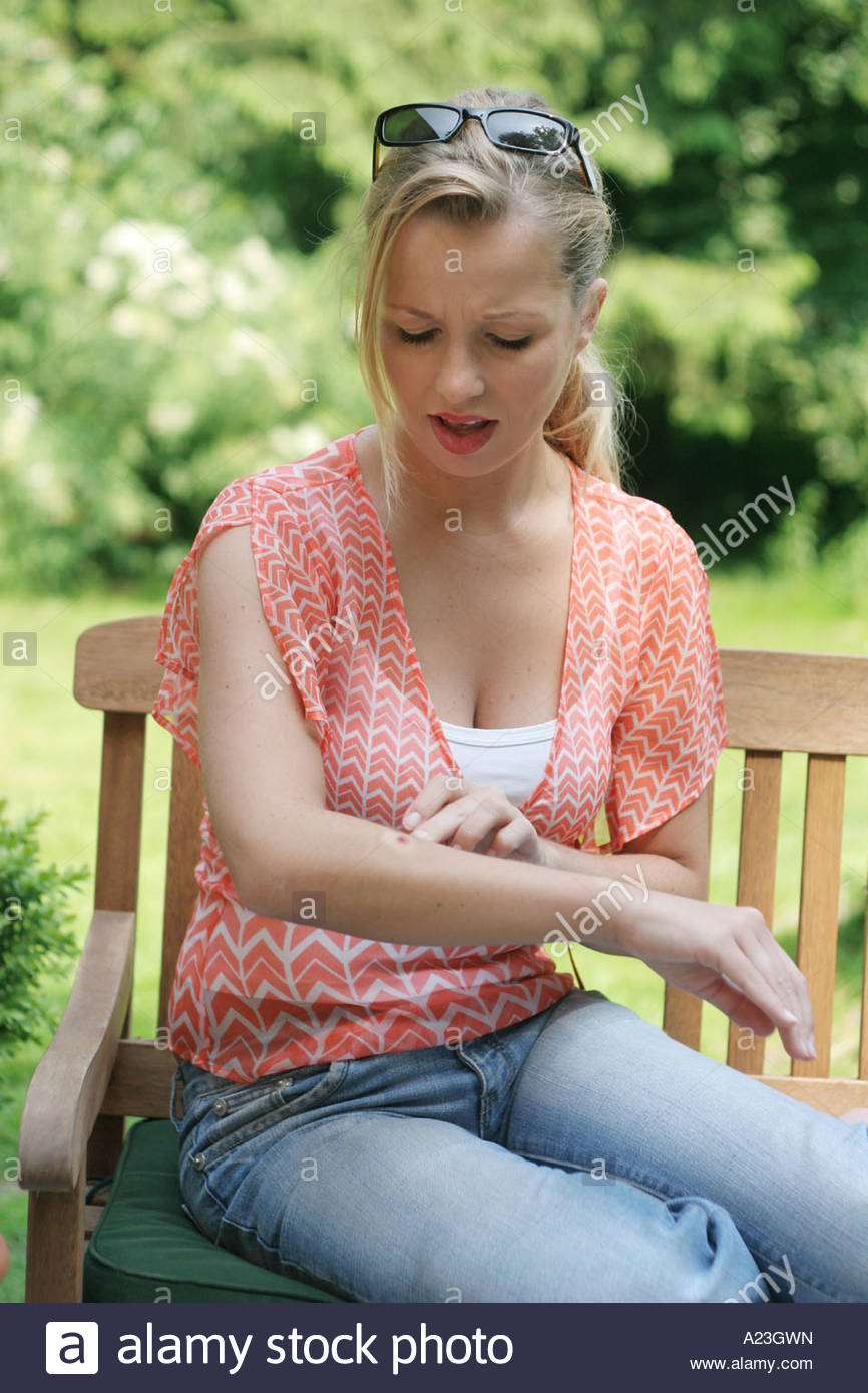 Woman Insect Bite High Resolution Stock Photography and Images - Alamy