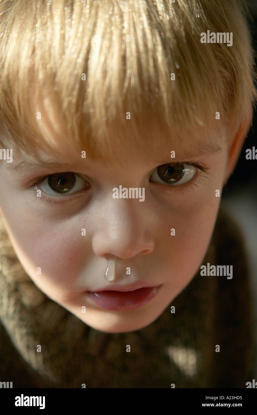boy with running nose Stock Photo - Alamy