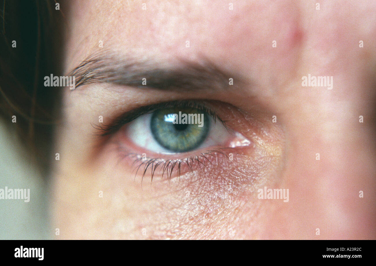 Eye socket hi-res stock photography and images - Alamy